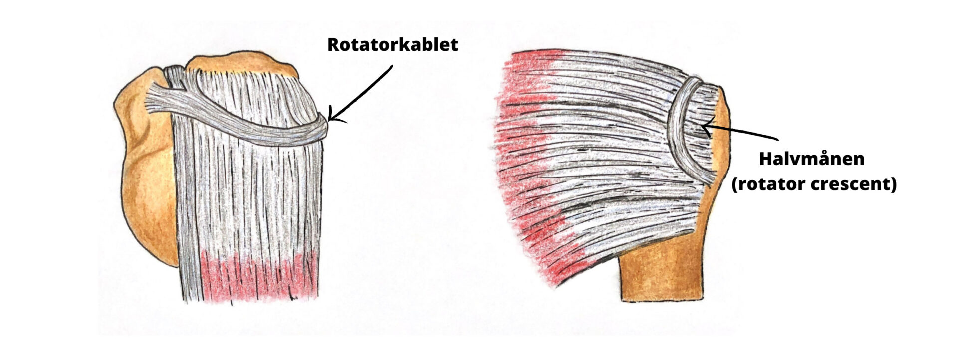 Rotator cuff læsion og skuldersmerter - Nyeste viden om behandling